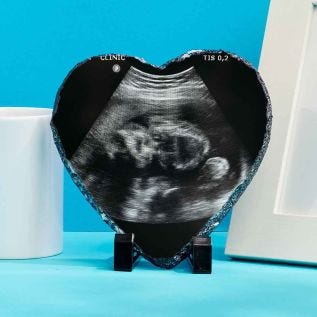 Personalised Baby Scan Gifts in Romford | Snappy Snaps